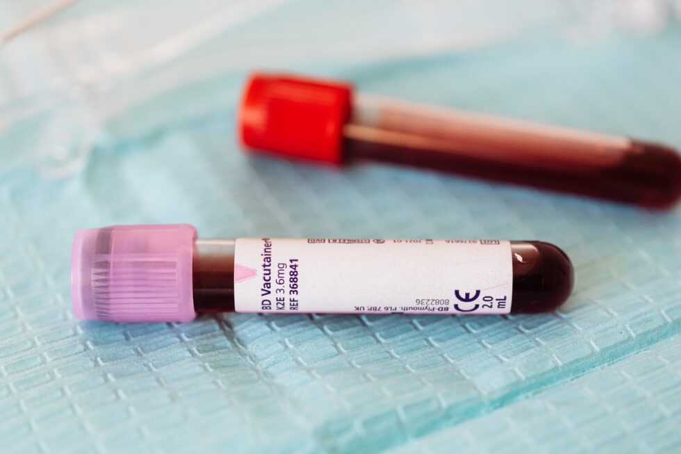 Which Blood Tests Require Fasting? What You Need to Know - Family ...